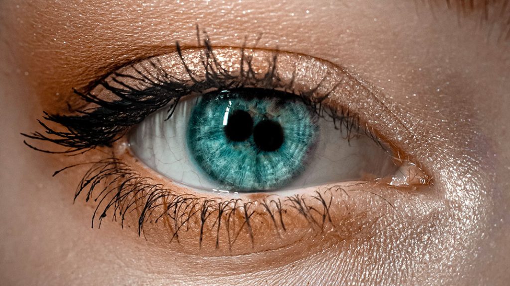 Policoria » Ojos con Dos Pupilas Otras Condiciones Raras